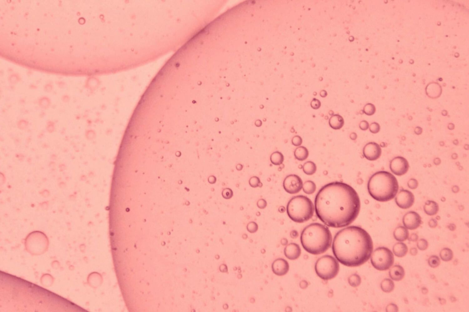 Can BV Turn Into Chlamydia? | Wisp